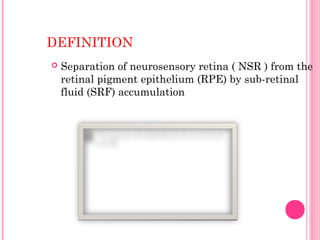 Acute Visual Loss | PPT