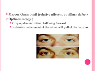 Acute Visual Loss | PPT