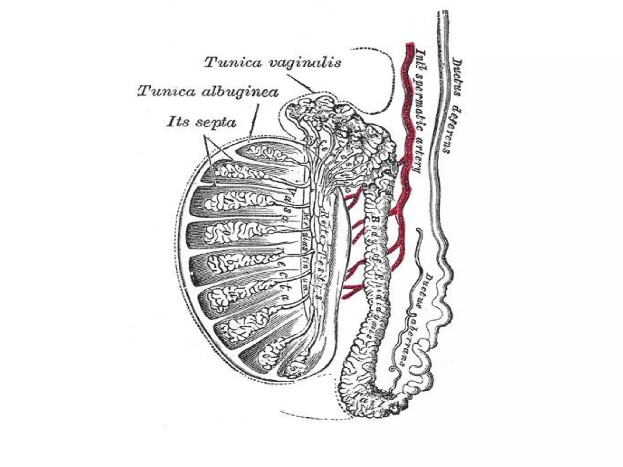 Acute vs chronic scrotal swelling | PPTX