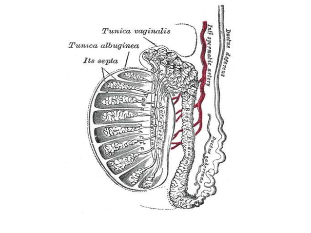 Acute vs chronic scrotal swelling | PPTX | Infertility | Reproductive ...