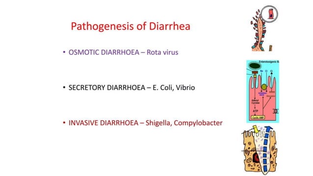 ACUTE WATERY DIARRHEA for final year MBBS.pptx | Digestive Disorders ...
