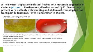 Acute Watery Diarrhea approach lecture .pptx