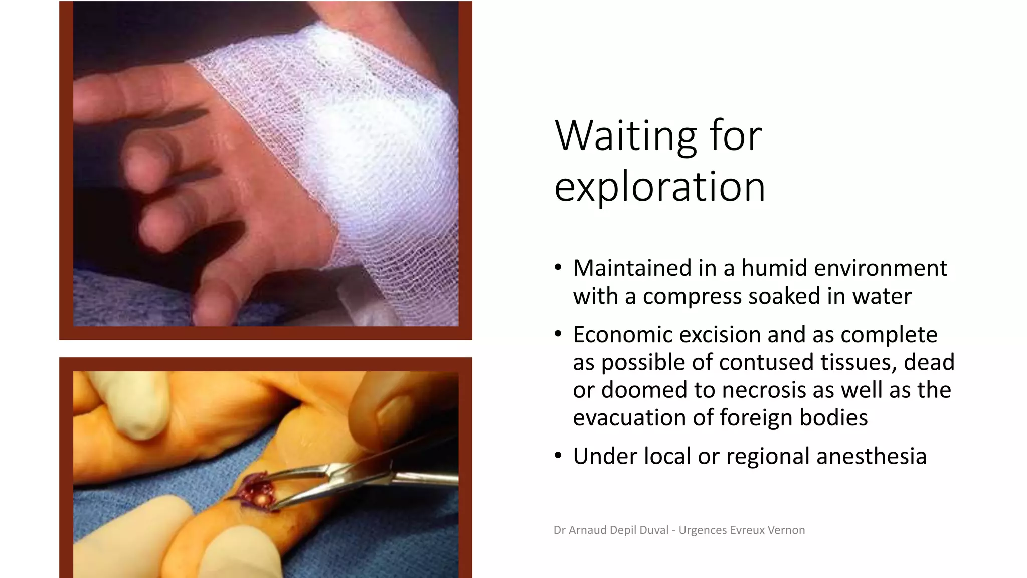 Acute & Traumatics wounds - Infectious risk | PPT