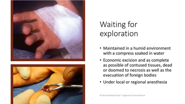 Acute & Traumatics wounds - Infectious risk | PPT