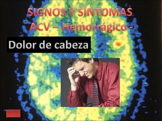 ACV | PPT