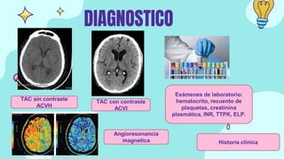ACV Resumen Internado.pptx-Practica internado extrahospitalario | PPTX