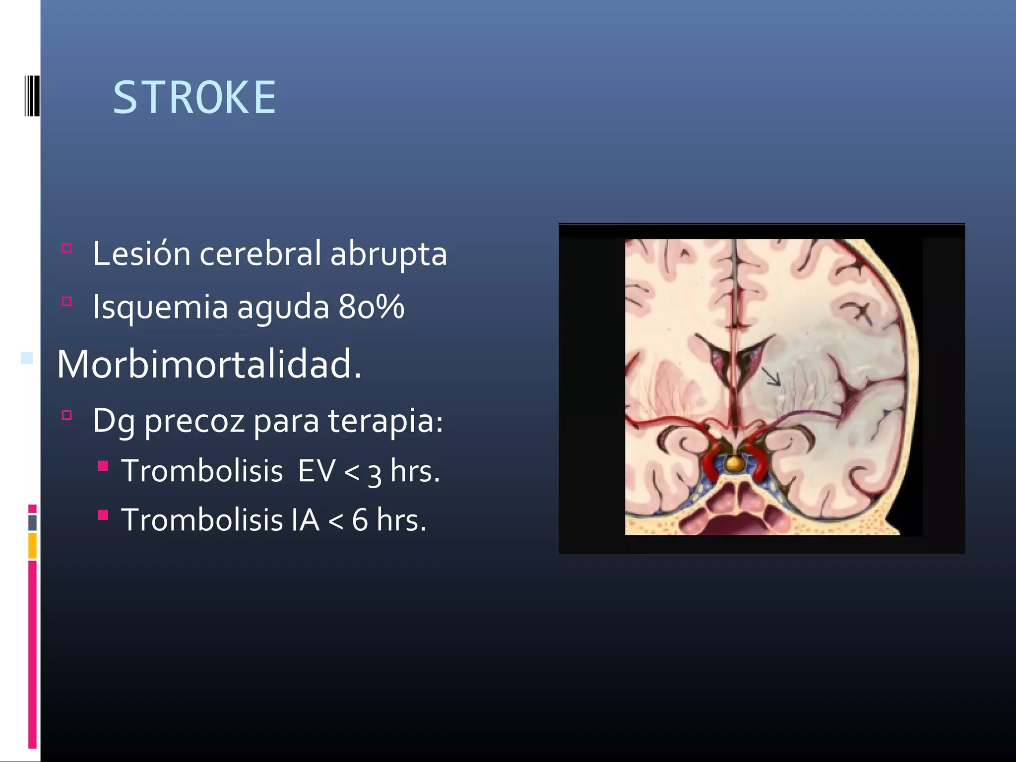 Accidente Cerebrovascular isquemico | PPT