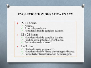 Acv Isquemico. | PPTX
