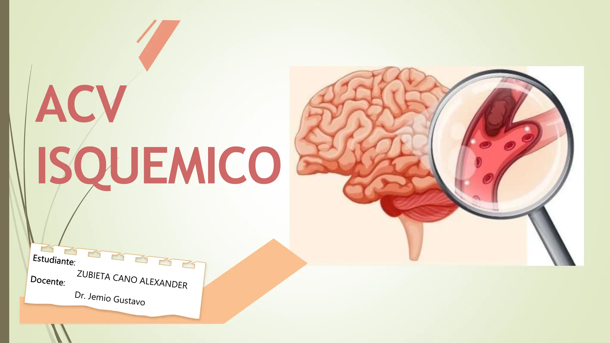 ACV ISQUEMICO - AZC.pptx................ | PPTX