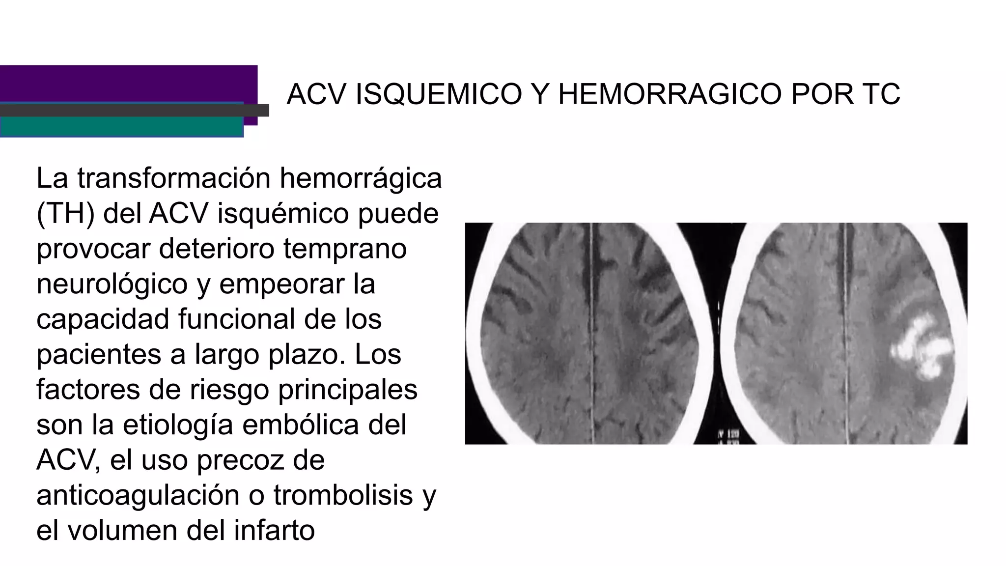 ACV isquemico y hemorragico.pptx