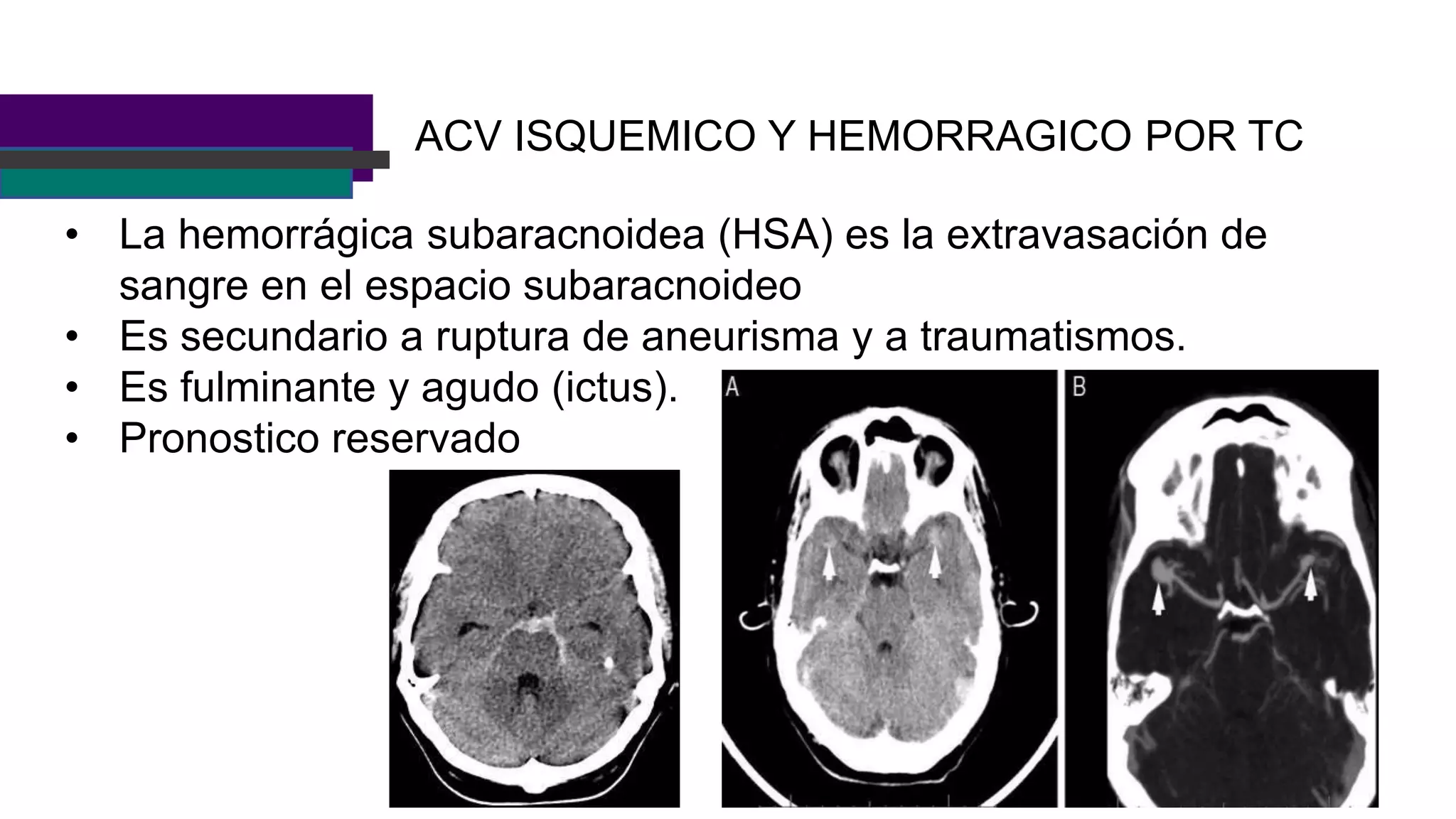 Acv Isquémico Y Hemorrágico: Conoce Las Diferencias – FSRASB