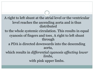 Acyanotic congenital heart defects | PPTX