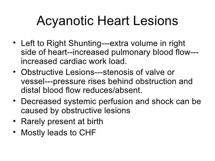 Acyanotic Heart Disease