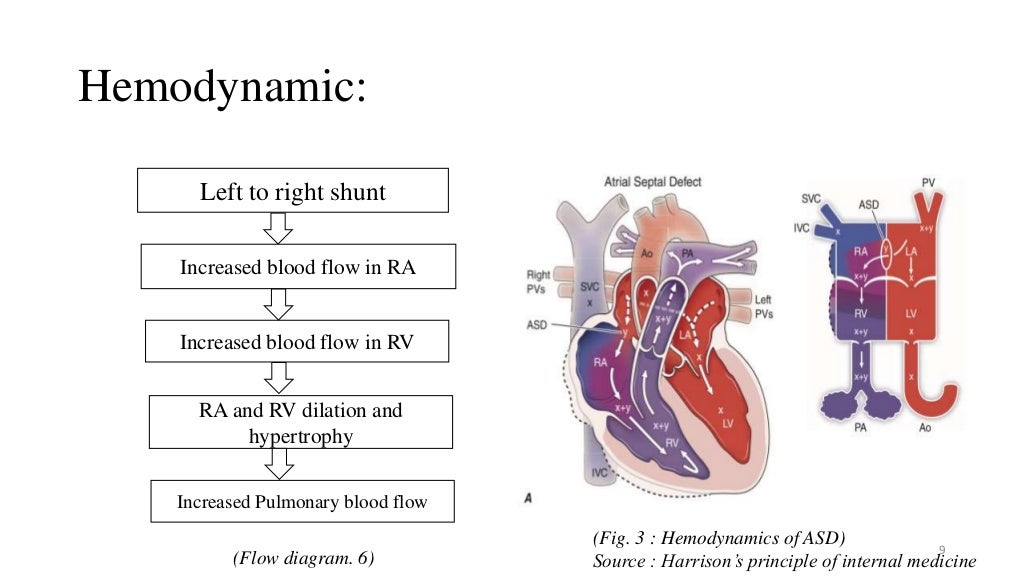 Acyanotic heart disease