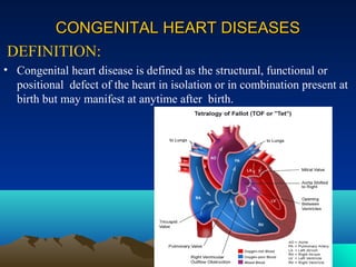 Acyanotic teaching practice | PPT
