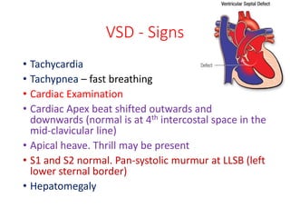Acynotic congenital heart disease 2021 | PPTX