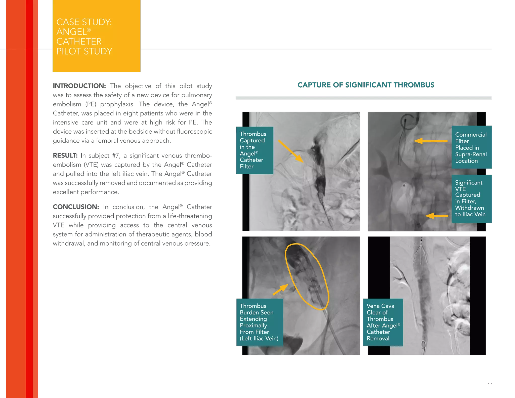 Angel Catheter Clinical Evidence Packet | PDF | Blood Disorders ...