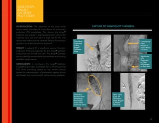 Angel Catheter Clinical Evidence Packet | PDF | Blood Disorders ...
