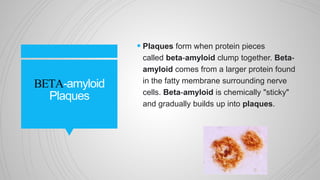 Alzheimer's disease | PPT