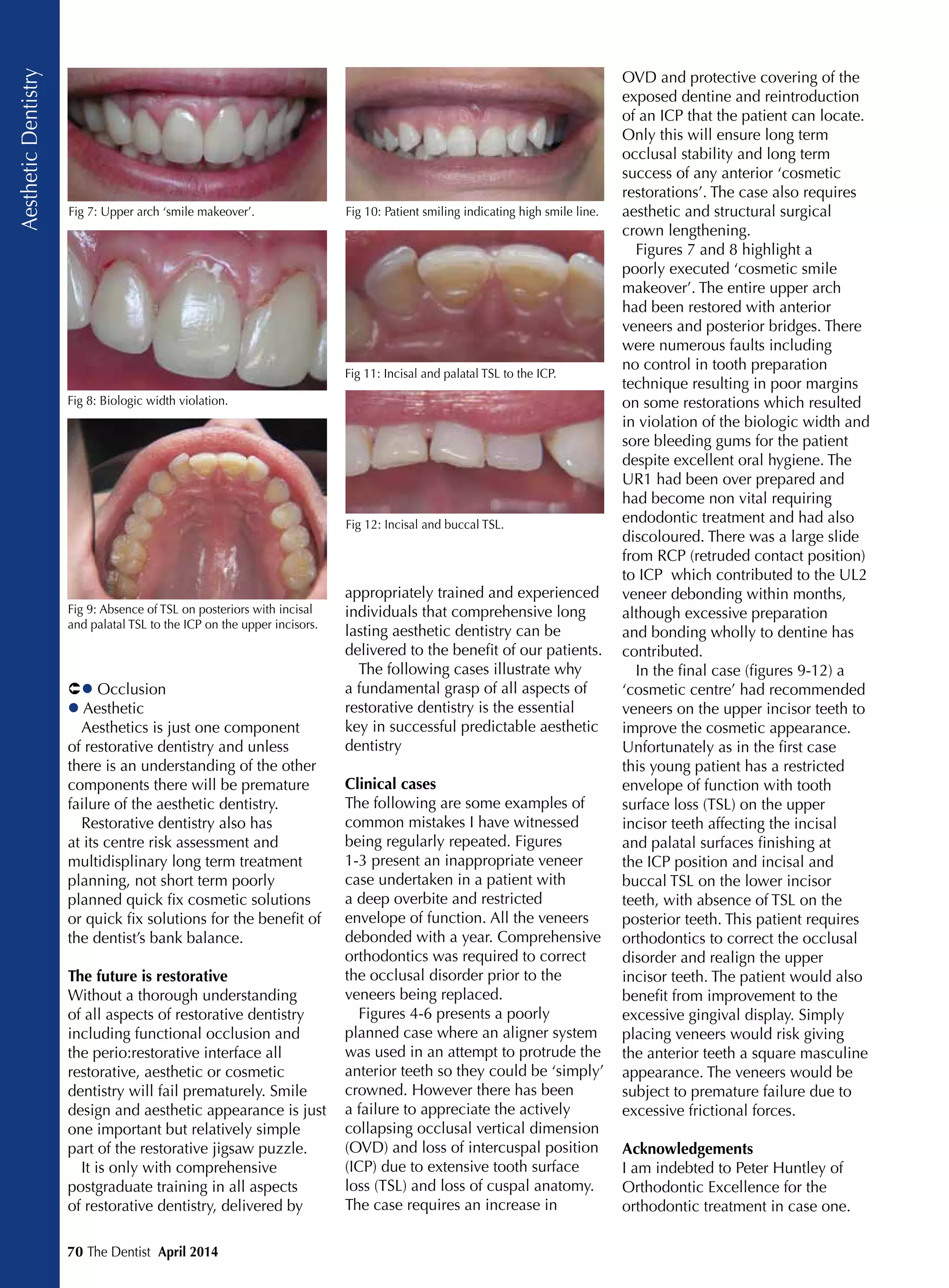 PD article Cosmetic, aesthetic or restorative_ (1) | PDF