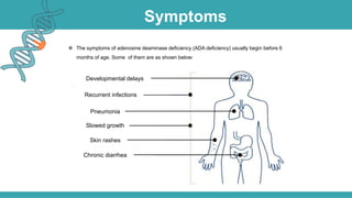 Adenosine Deaminase Deficiency | PPTX
