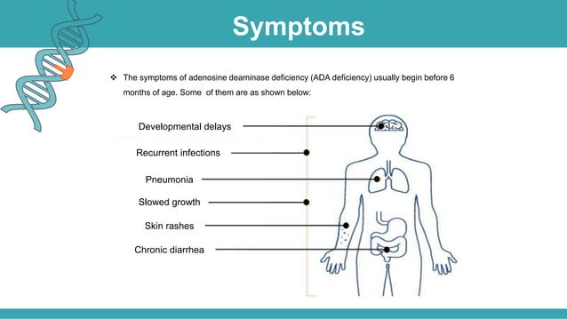 Adenosine Deaminase Deficiency | PPTX | Blood Disorders | Diseases and ...