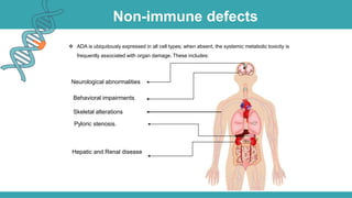 Adenosine Deaminase Deficiency | PPTX