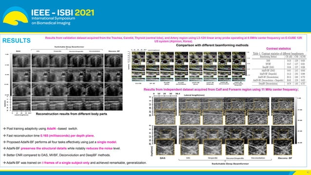 Switchable Deep Beamformer for Ultrasound Imaging Using ADAIN | PDF ...