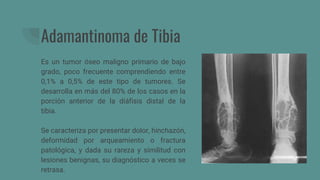 ADAMANTINOMA DE TIBIA.pptx