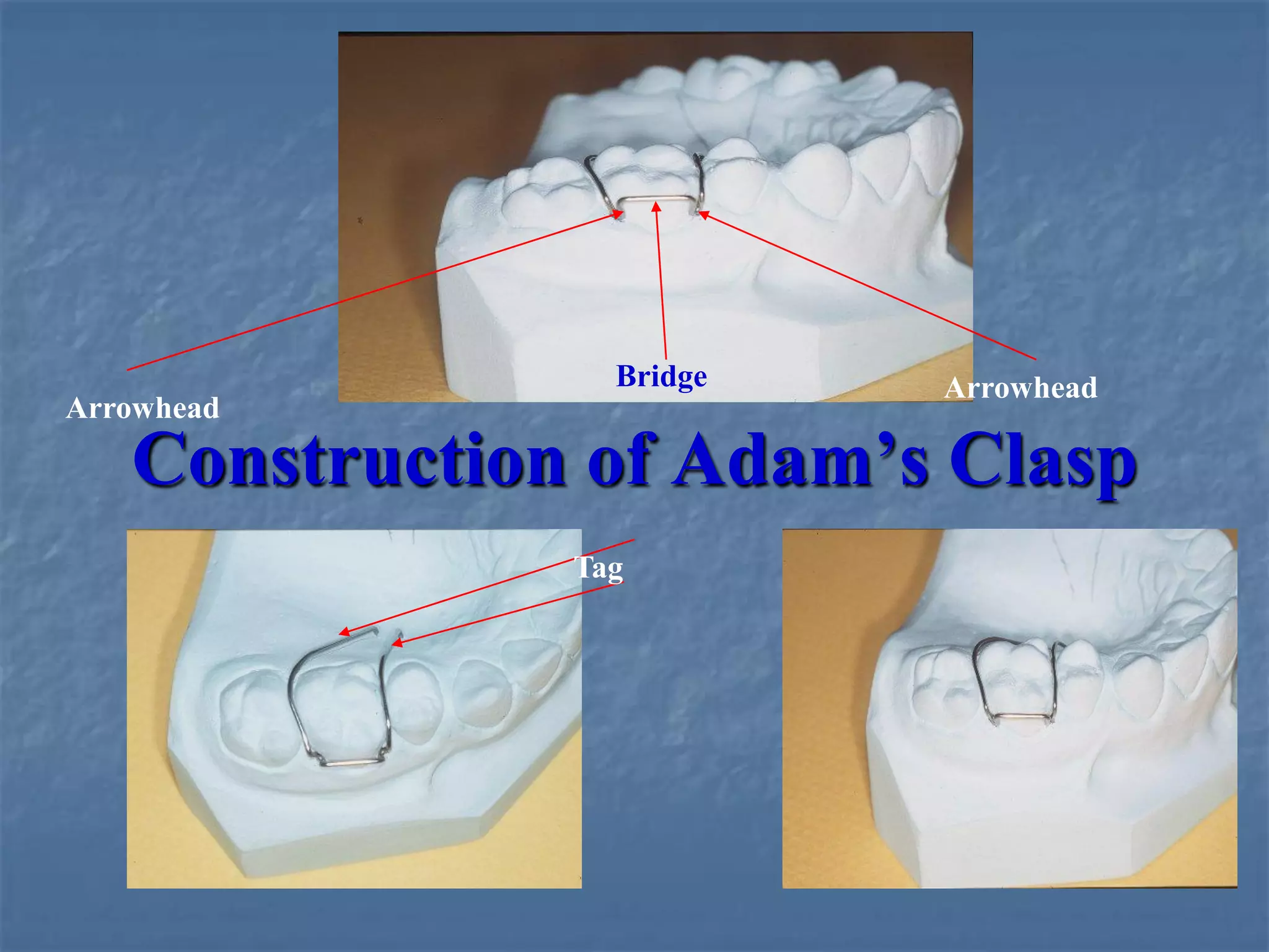 Adam's clasp | PDF