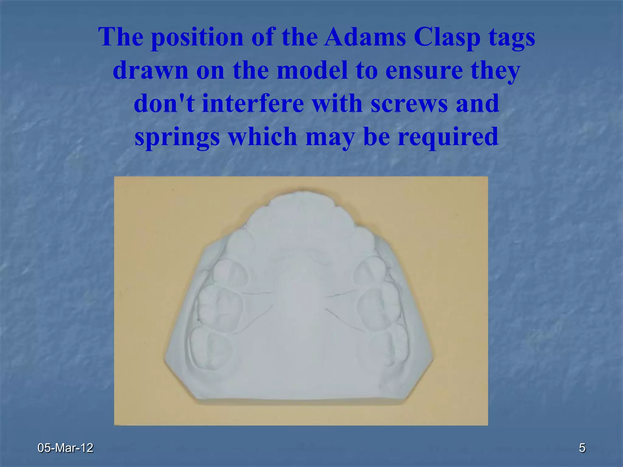 Adam's clasp | PDF