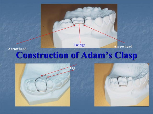 Adam's clasp | PDF
