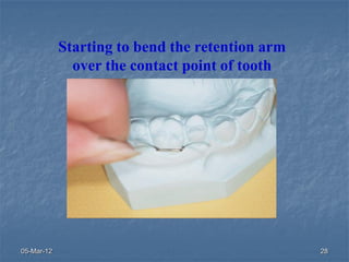 Adam's clasp | PDF