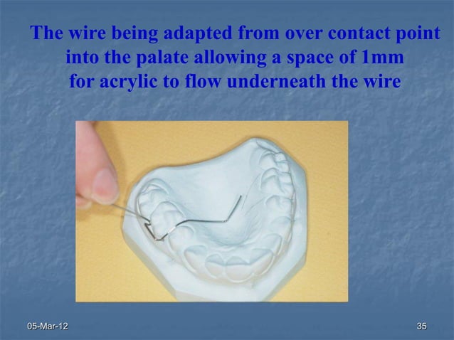Adam's clasp | PDF