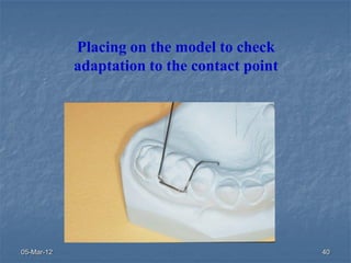 Adam's clasp | PDF