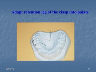 Adam's clasp | PDF