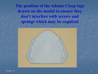 Adam's clasp | PDF