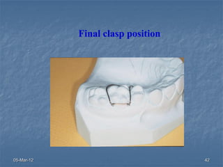 Adam's clasp | PPT