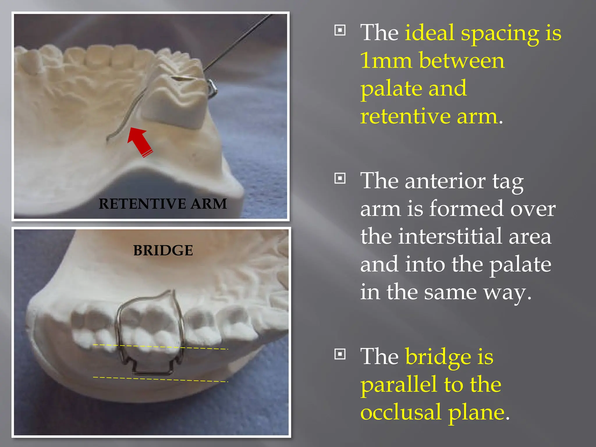 Adams Clasp Construction.pptx Adams Clasp Construction.pptx