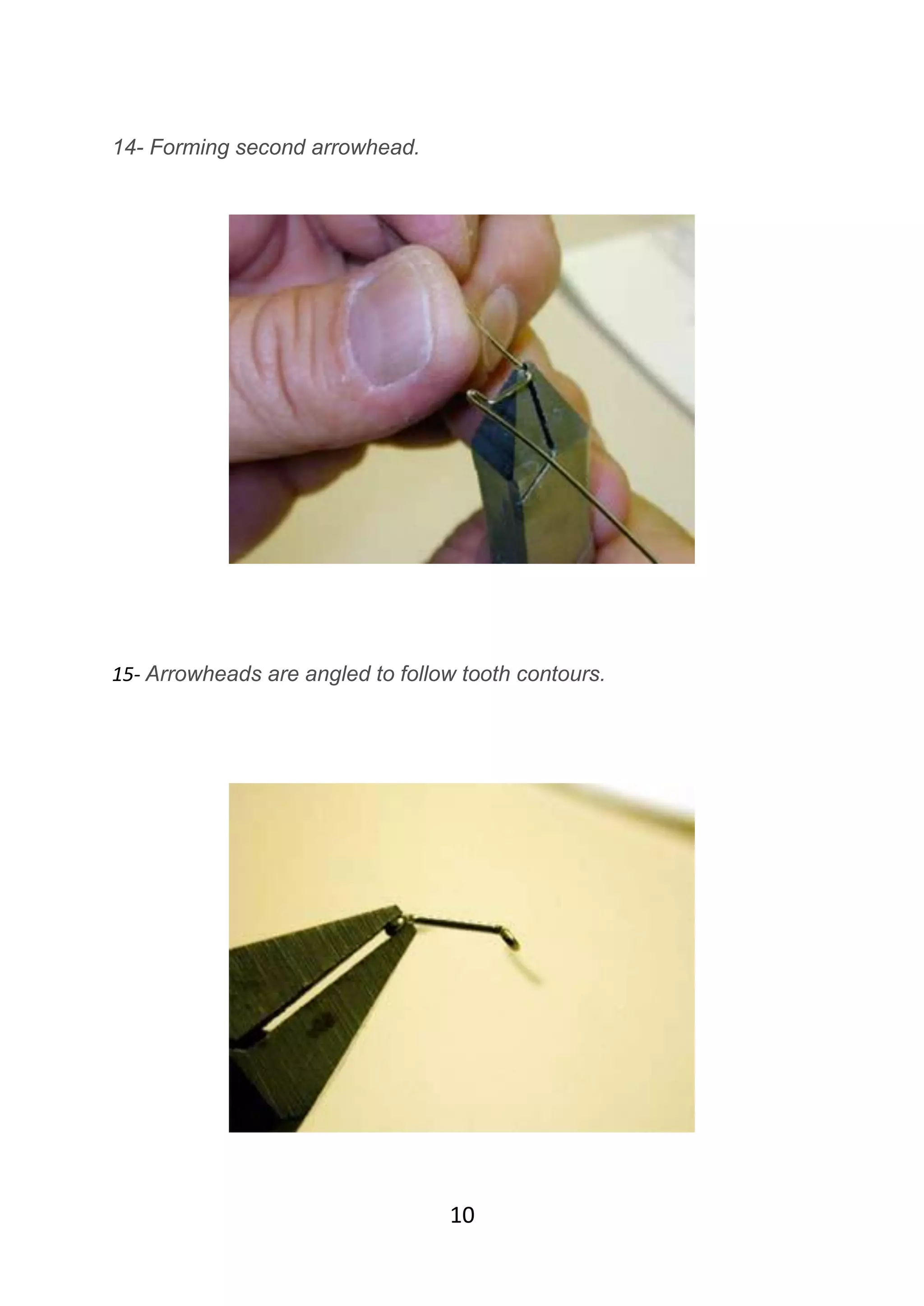 Adams clasp practice | PDF