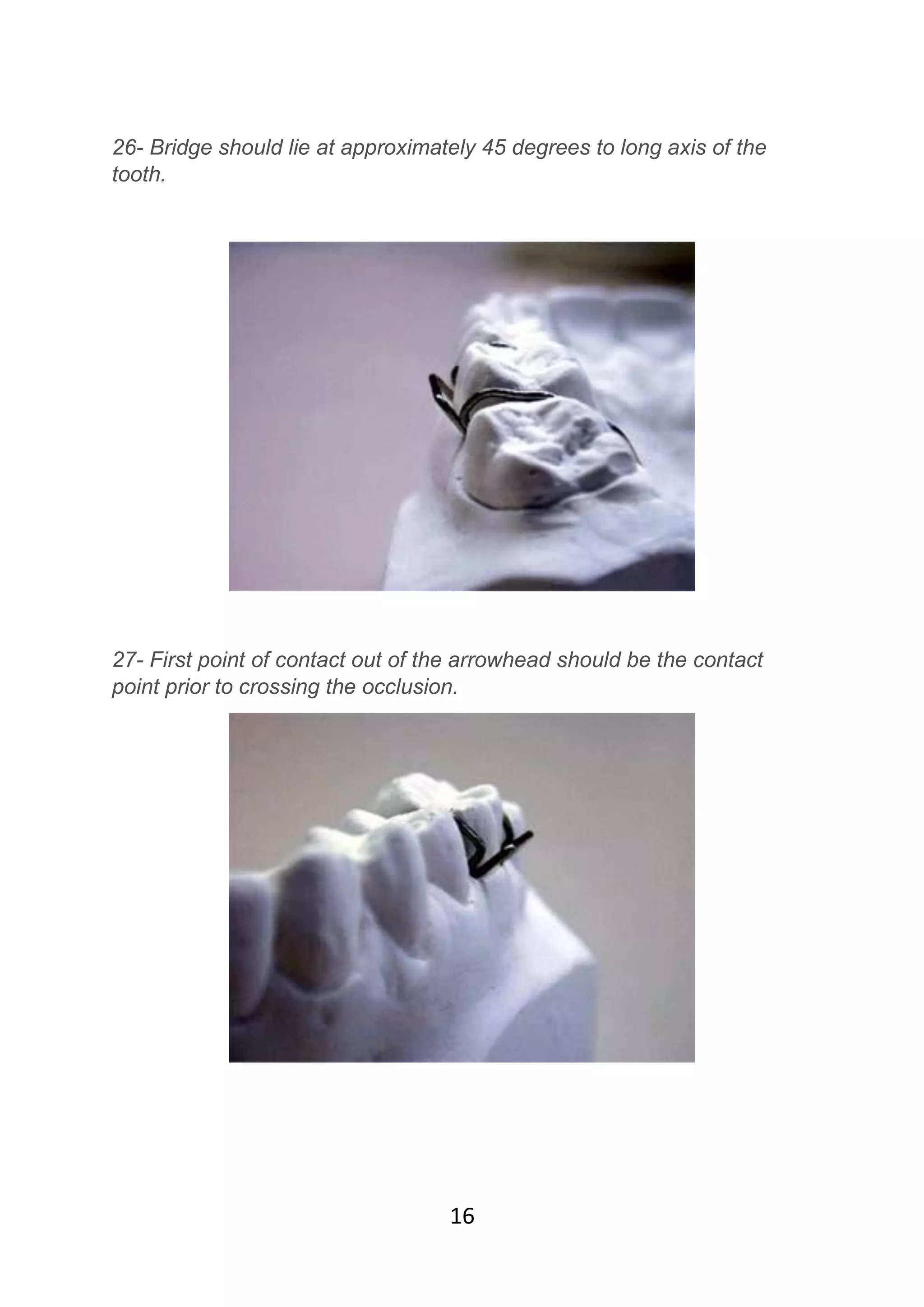 Adams clasp practice | PDF