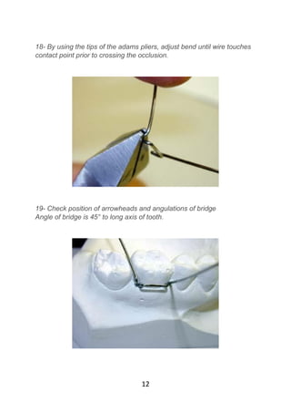 Adams clasp practice | PDF