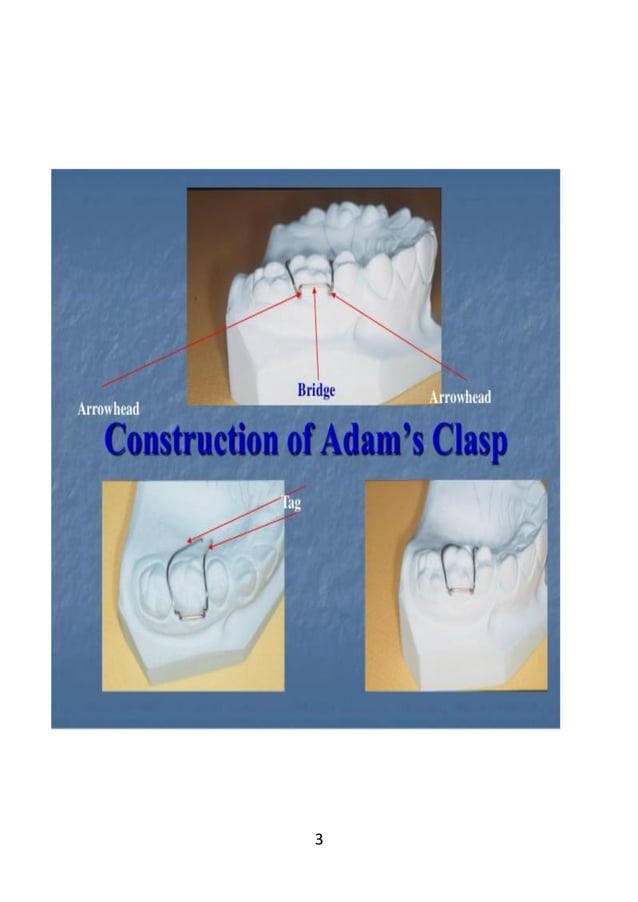 Adams clasp practice | PDF | Dental Health | Diseases and Conditions