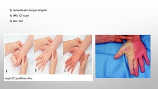 adam thromboangitis buerger's disease, medical faculty | PPTX