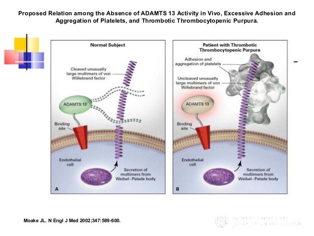 ADAMTS13 Presentation
