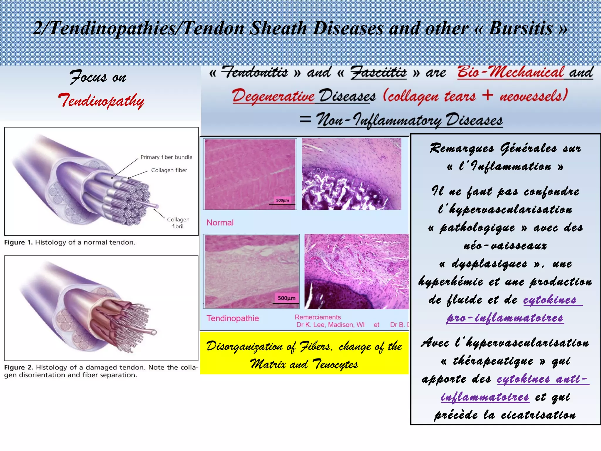 Use of PRP-HA for the treatment of Articular and Periarticular diseases ...