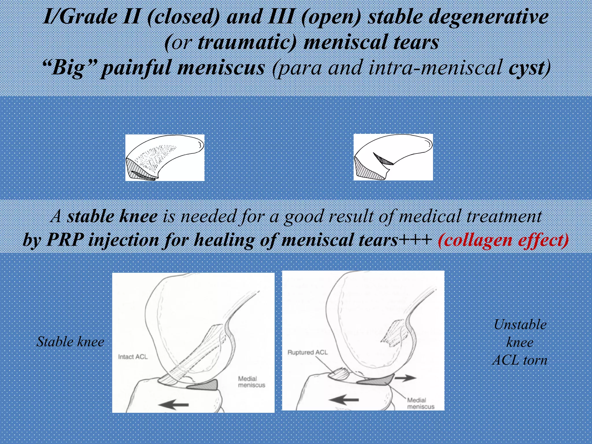 Use of PRP-HA for the treatment of Articular and Periarticular diseases ...