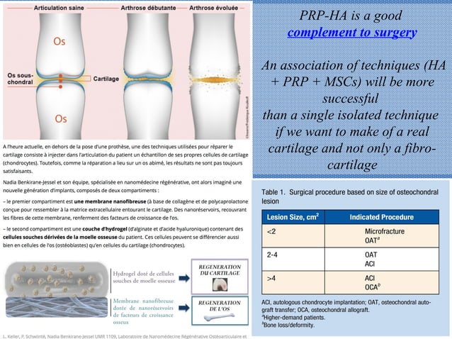 Use of PRP-HA for the treatment of Articular and Periarticular diseases ...
