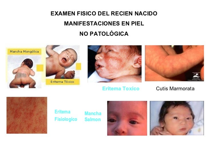 Adaptacion Y Examen Fisico