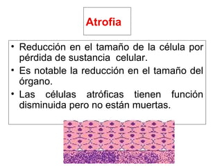 Atrofia Celular